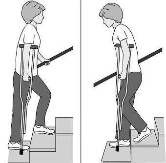 3 Techniques for Climbing the stirs while suffering from Knee Pain ...